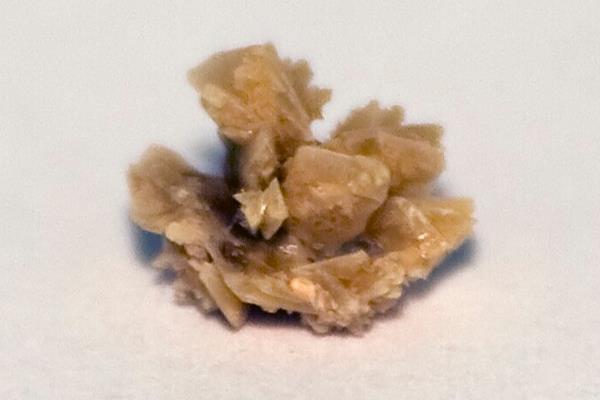 Researchers discover a previously unknown bacterial component in kidney ...