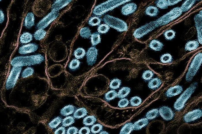 Bovine H5N1 influenza from infected worker transmissible and lethal in ...