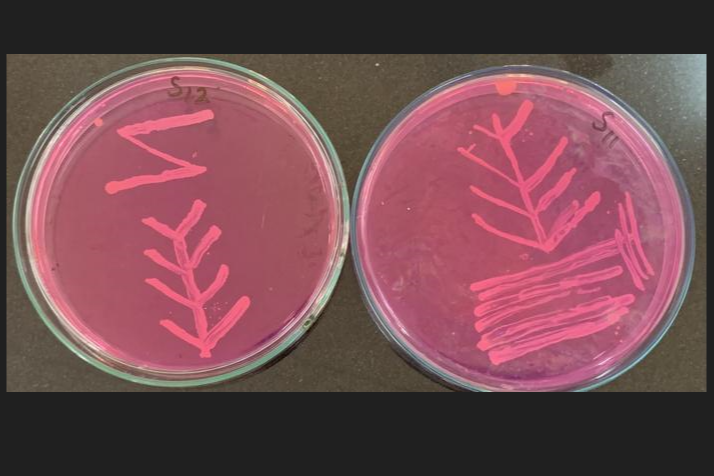 Study finds high rates of antibiotic-resistant bacteria in raw milk ...