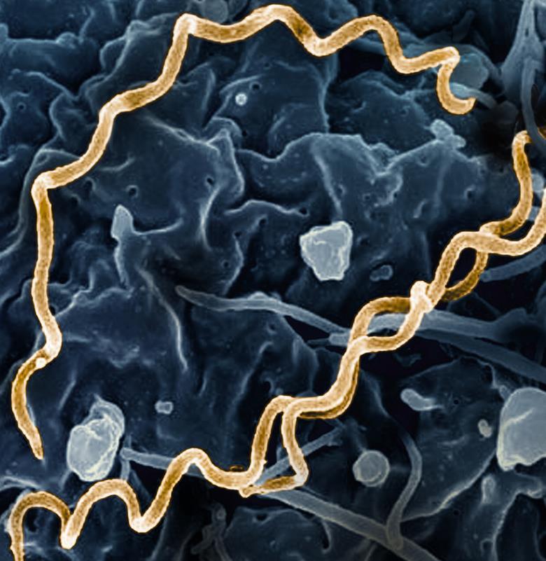 Under the microscope: syphilis | Features | The Microbiologist