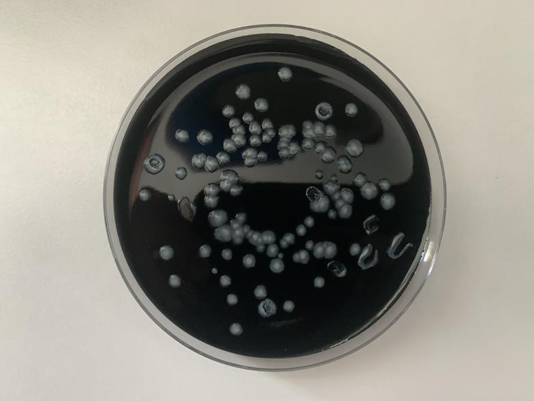 Changing the culture of Legionella testing | Features | The Microbiologist